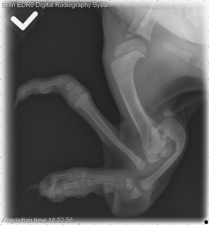 Ectrodactyly X Rays